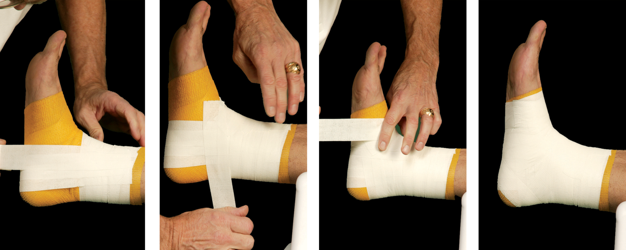 Taping Methods for Ankle Injuries - OVIK Health