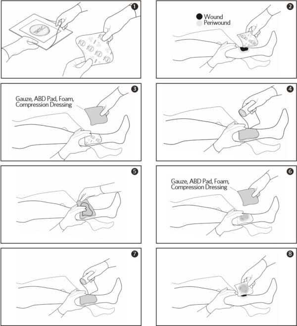 TRITEC® Instructions For Use (IFU) - OVIK Health