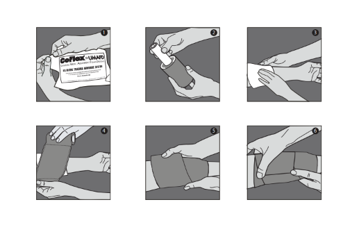 CoFlex® AFD Instructions For Use (IFU) - OVIK Health